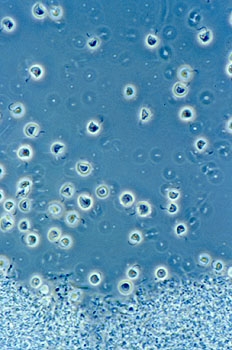 Meet the Protistologist – It Came from the Pond