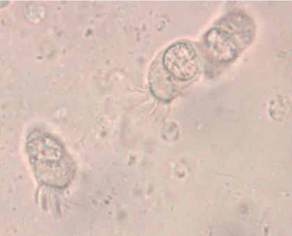 Lophomonas blattarum – It Came from the Pond