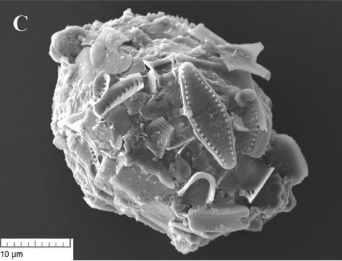 Difflugia pulex – It Came from the Pond